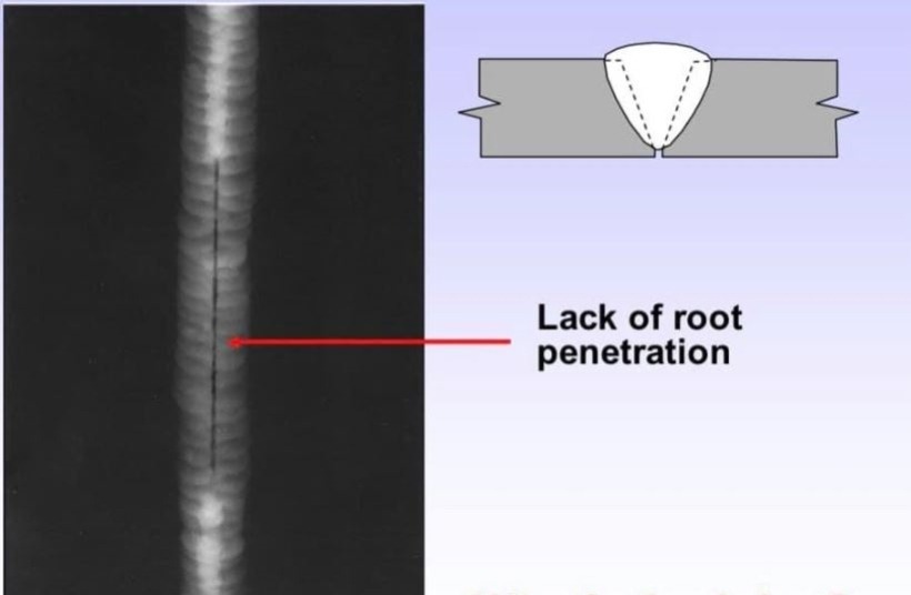 Radiographs of Welds Defect - Lack of root penetration. - The Engineers ...